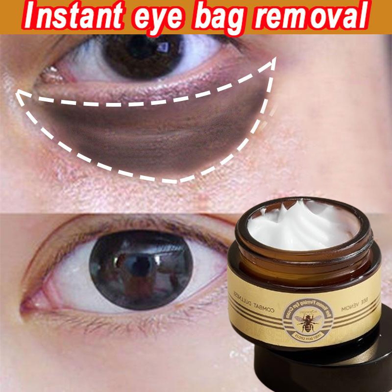 Jual Eye cream menghilangkan milia menghilangkan keriput di mata dan ...
