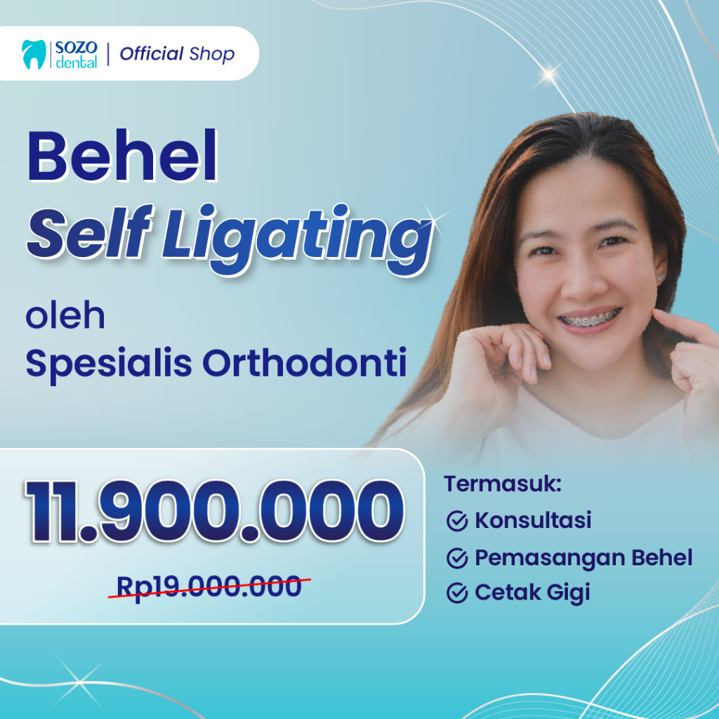 Jual Behel Self Ligating SPESIALIS ORTHODONTI: Pemasangan Rahang Atas ...