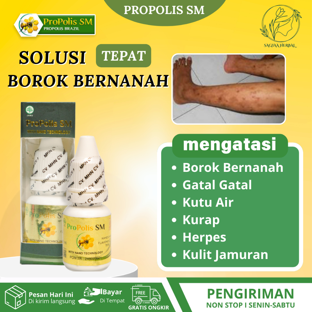 Jual Obat Borok Bernanah Gatal Gatal Kutu Air Kurap Herpes Kulit ...