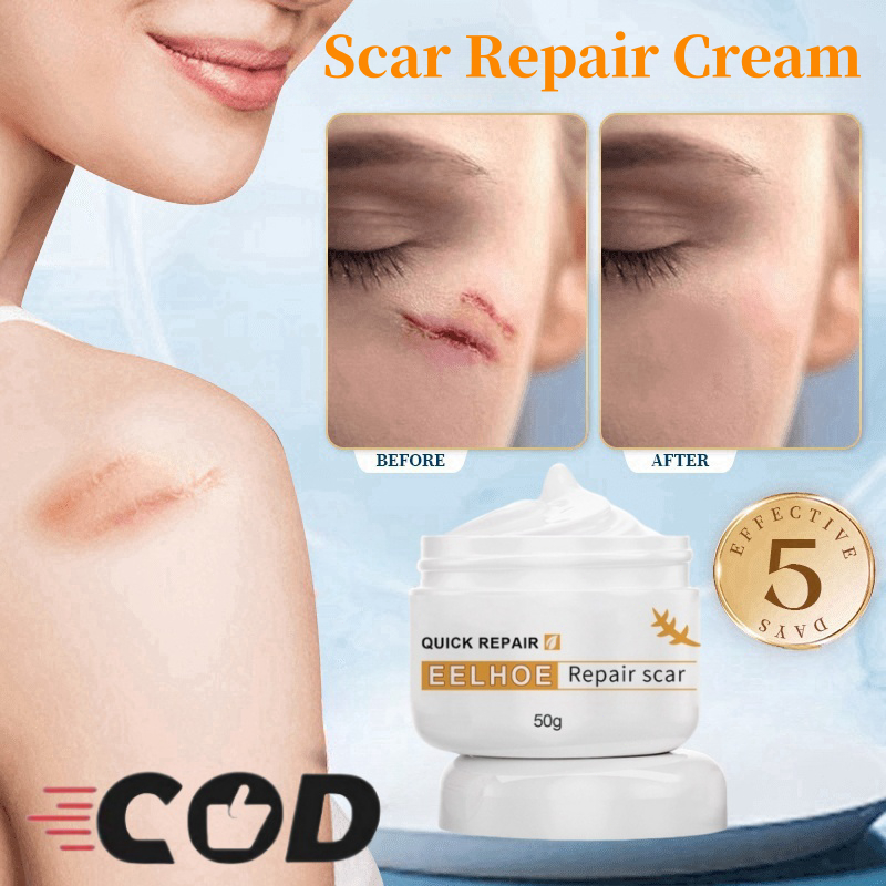 Jual 【COD ORI】EELHOE Scar Repair Cream 50gr Obat Penghilang Bekas Luka ...
