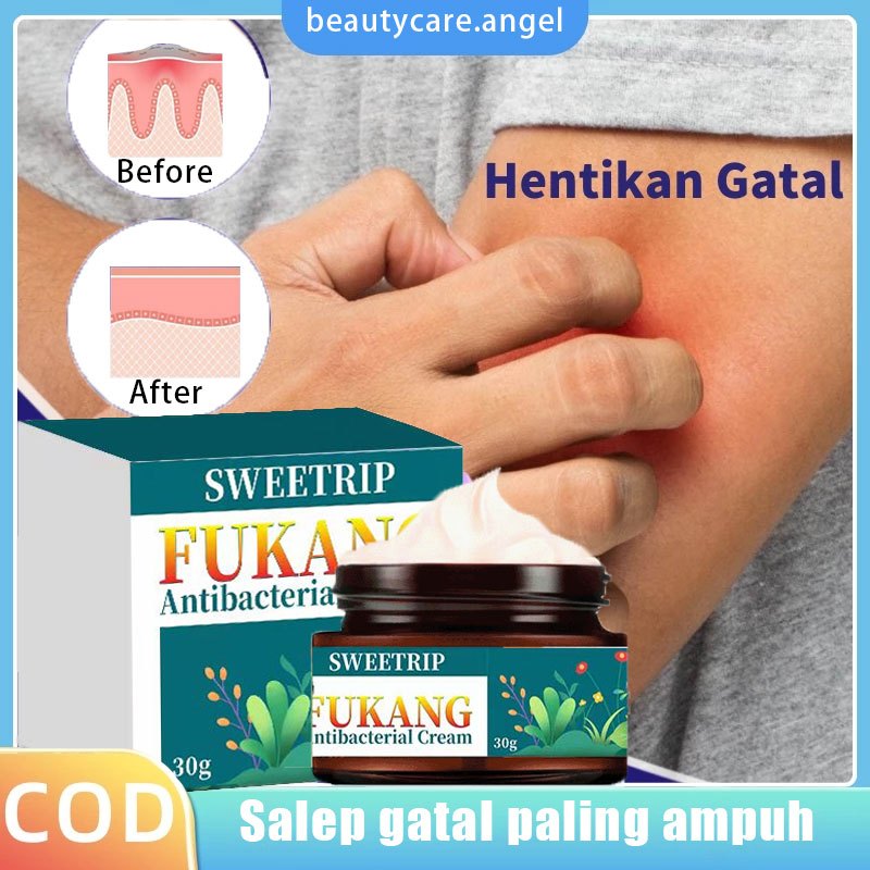 Jual Salep gatal paling ampuh 30g Salep gatal selangkangan obat alergi ...