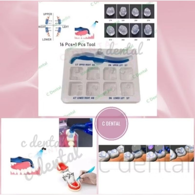 Jual [1 Set] Dental Occlusal Duplicate Stamp Composite Restoration ...