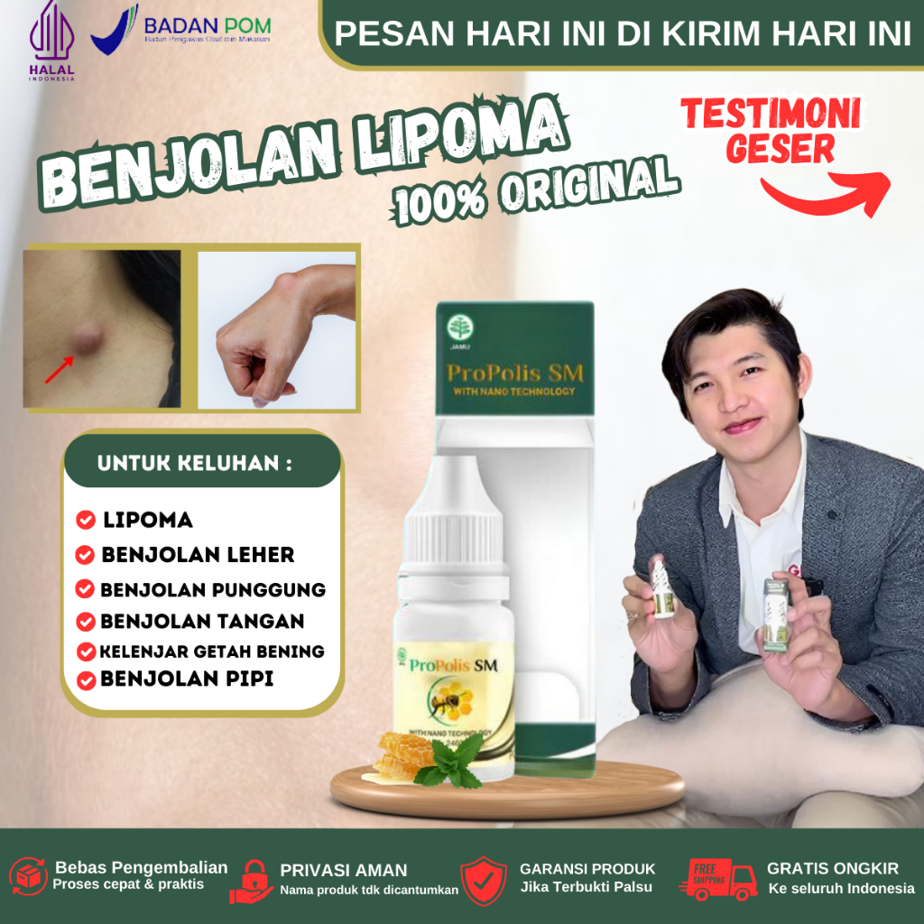 Jual Propolis SM - Obat Benjolan di leher, Obat kelenjar getah bening ...