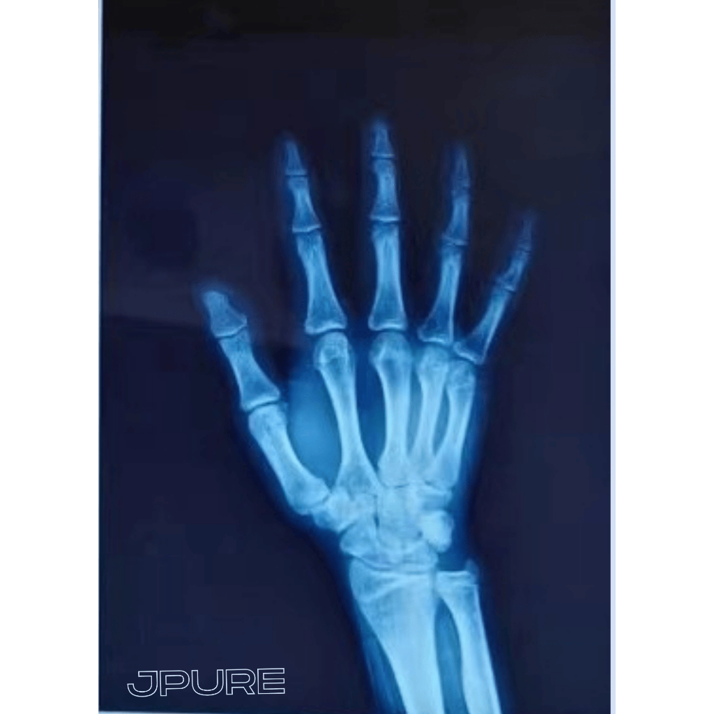 Jual Cetak Foto Image Medical Radiologi Rontgen X-ray CT-scan | Dry ...
