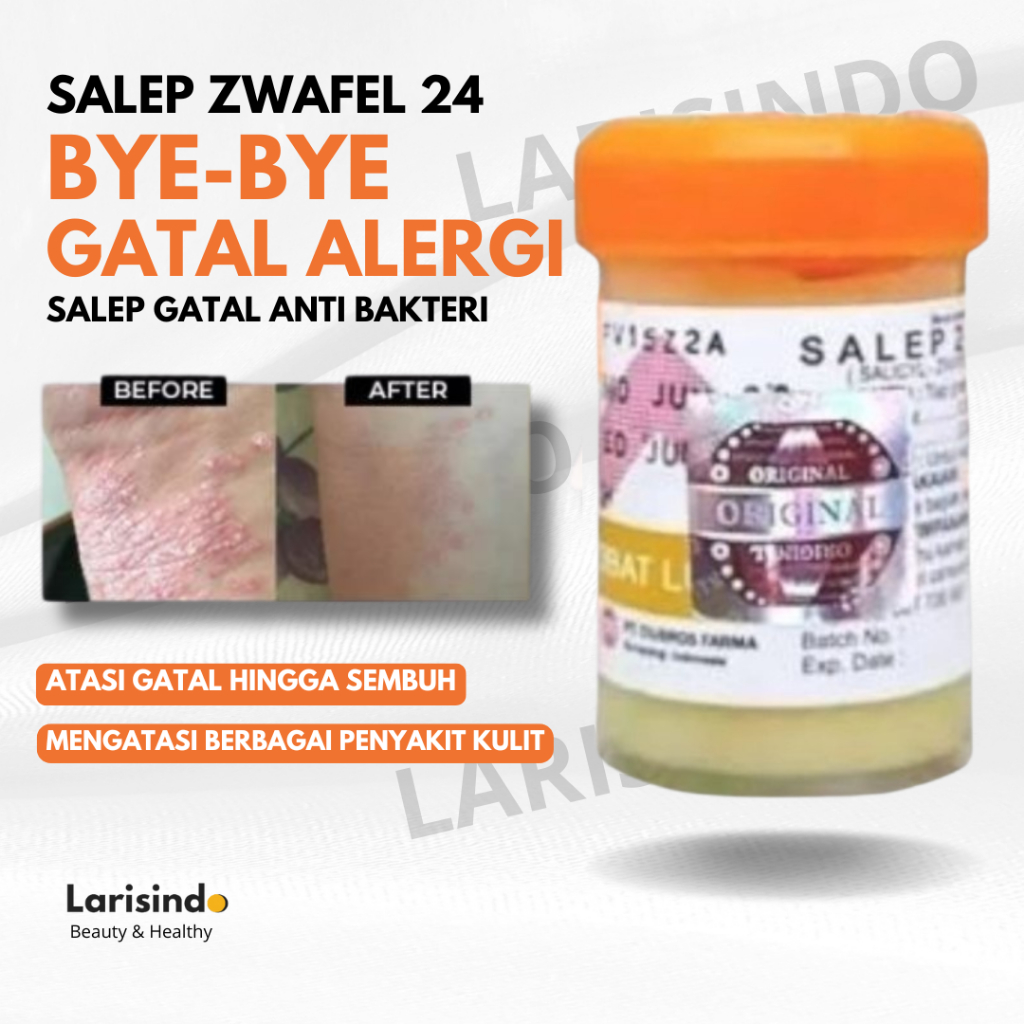 Jual 𝗦𝗔𝗟𝗘𝗣 𝗭𝗪𝗔𝗙𝗘𝗟 𝗜𝗧𝗖𝗛𝗬 𝟮𝟰 Belerang Sulfur 100% Original BPOM Saleb ...