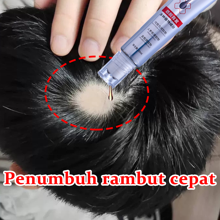 Jual Penumbuh rambut cepat dan tebal Serum penebal rambut Perawatan ...