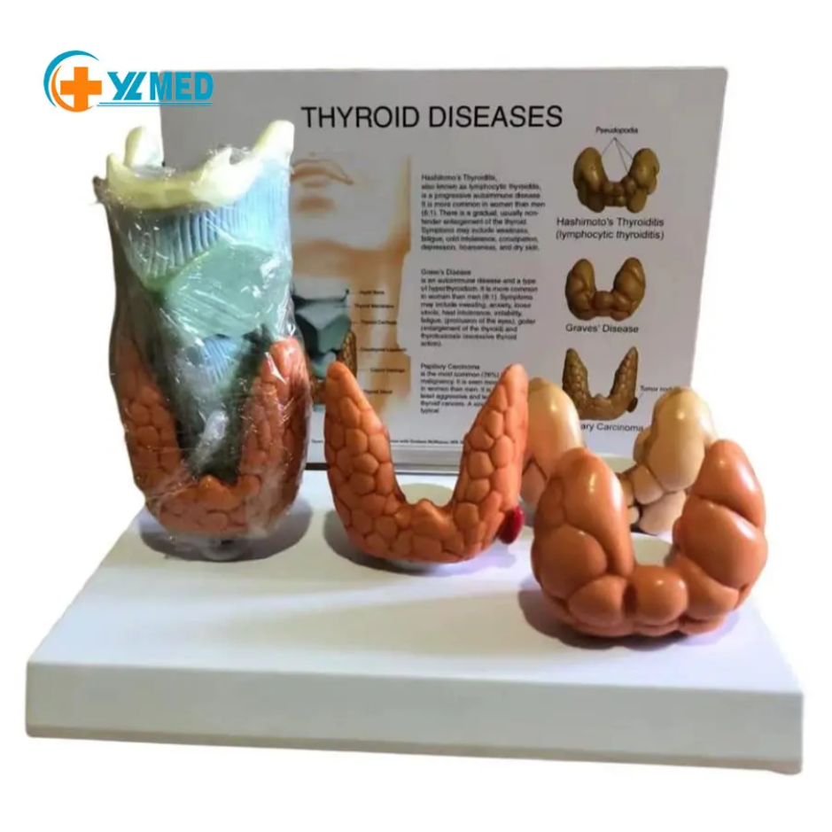 Jual Alat Peraga Tiroid Thyroid Pathology Model Endocrinology Thyroid ...