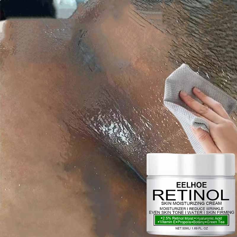 Jual mencerahkan selangkangan dan miss v cream pemutih ketiak dan ...