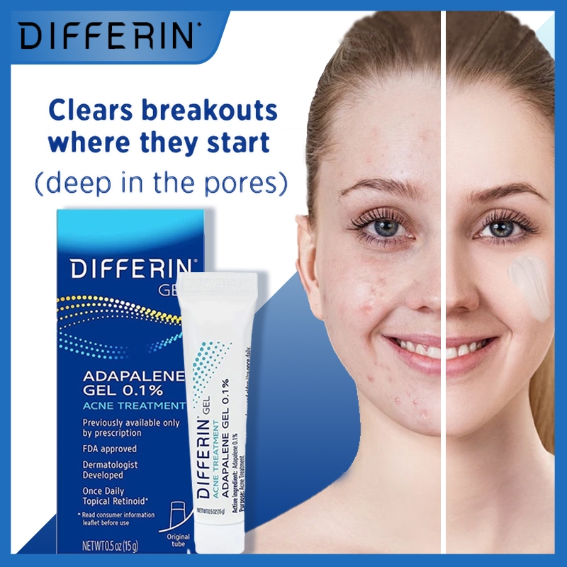 Jual Differin Acne Treatment Gel 15gr/Differin adapalene gel 0.1% acne treatment/Made In USA ...