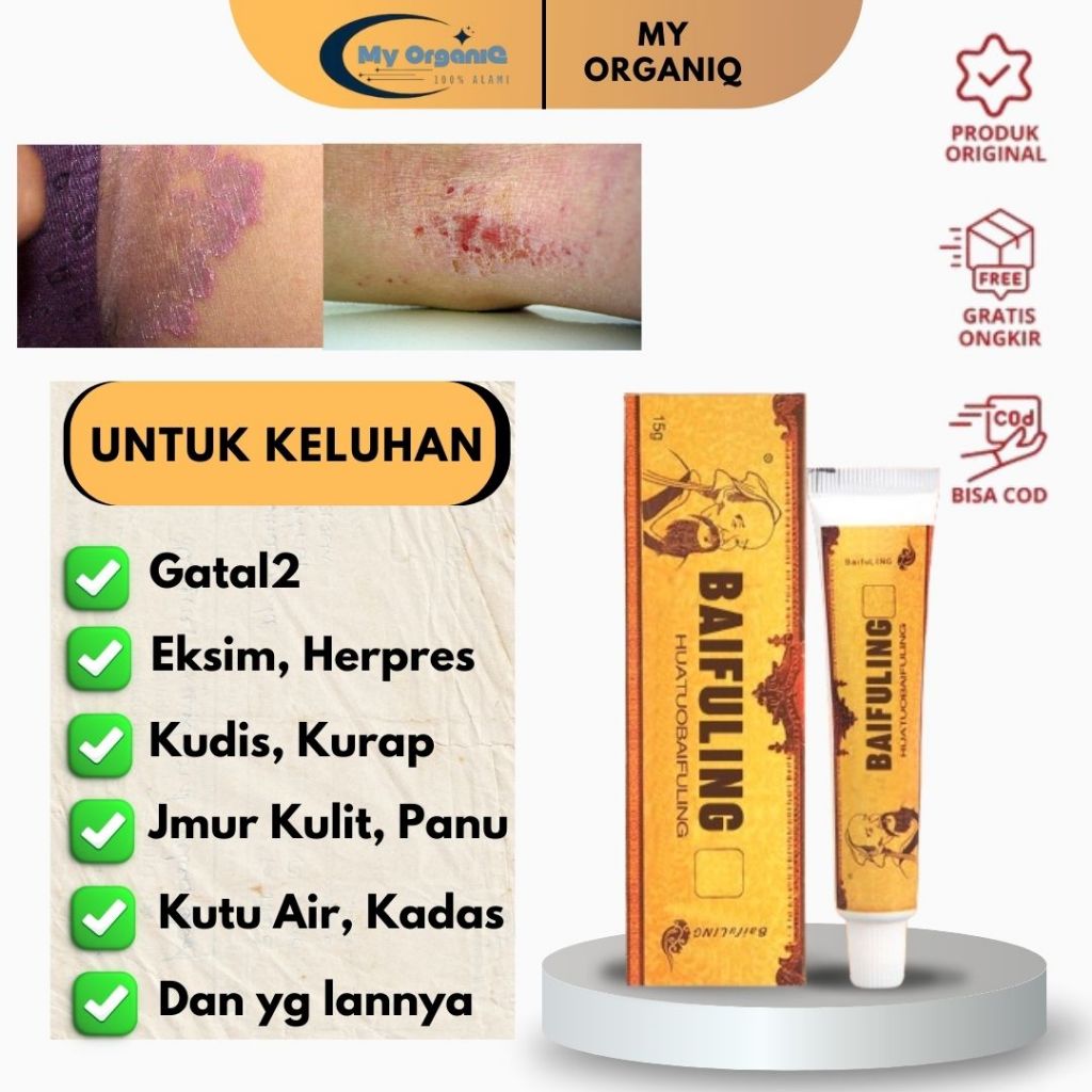 Jual Cream Salep Huatuobaifuling Salep Kulit China Eksim Kering Paling ...
