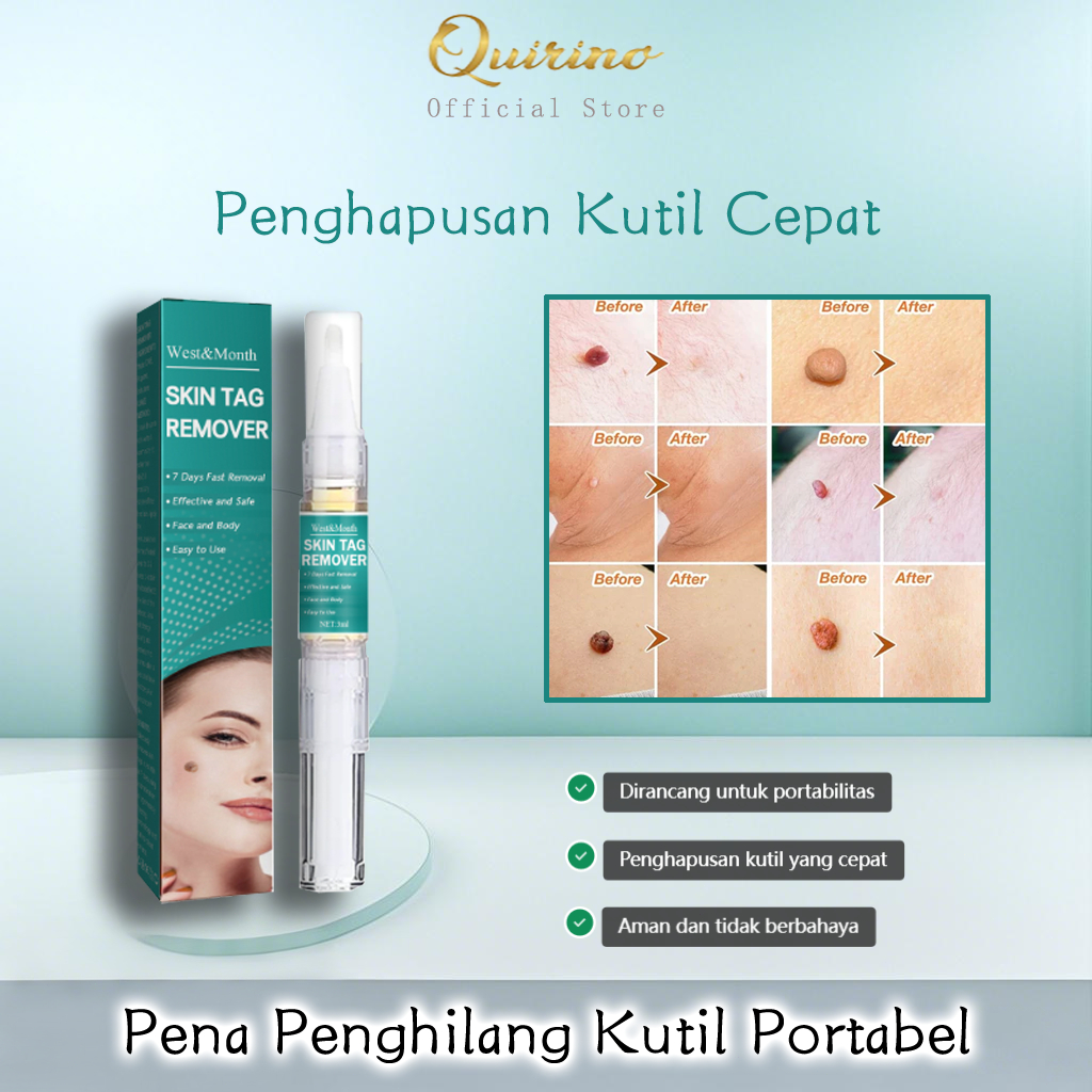 Jual Quirino Penghilang Tahi Lalat Penghilang Kutil Skin Tag Remover ...