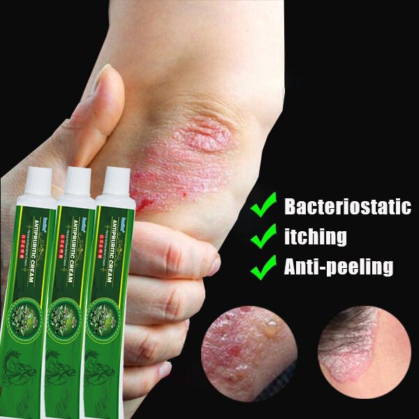 Jual Krim antibakteri dan antigatal 20g Kaki Kurap Berkeringat Herpes ...