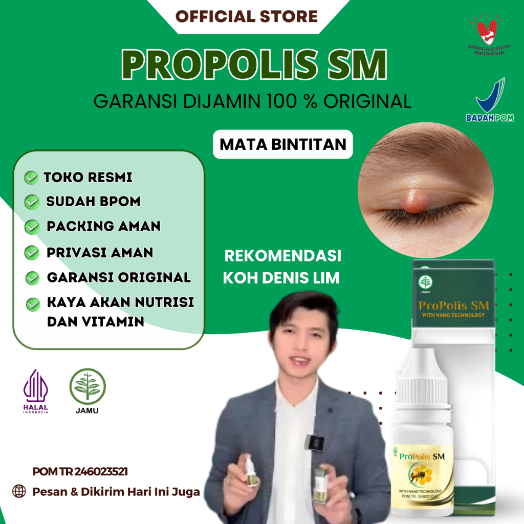 Jual Propolis SM Obat Mata Bintitan Benjolan di Kelopak mata Bengkak ...