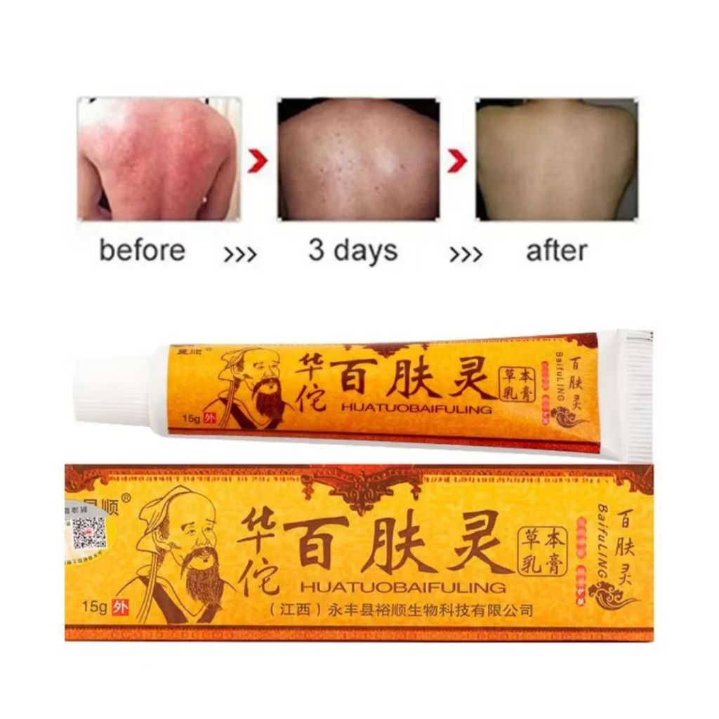 Jual Salep Gatal Baifuling Salep Cap Orang Tua Cream Gatal Eksim Jamur ...