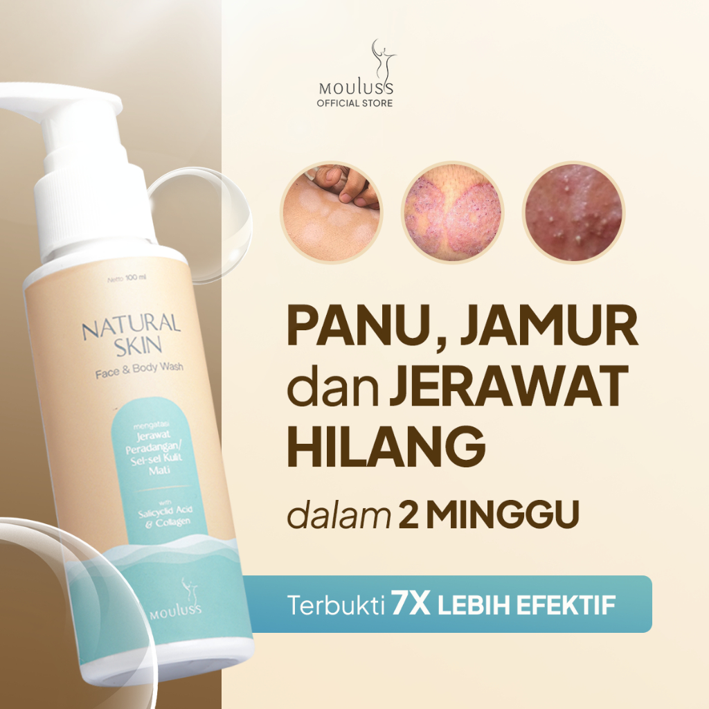 Jual (GARANSI 100%) Mouluss Natural Skin - Menghilangkan panu, gatal ...