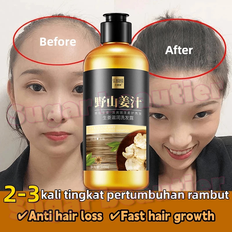 Jual Conditioner Penumbuh Rambut Cepat Ginger 300ml pertumbuhan rambut Pengendalian Minyak Anti ...