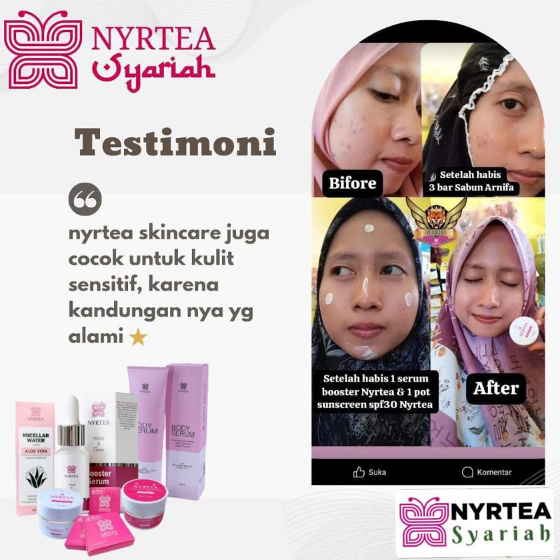 Jual paket lengkap nyrtea | Shopee Indonesia