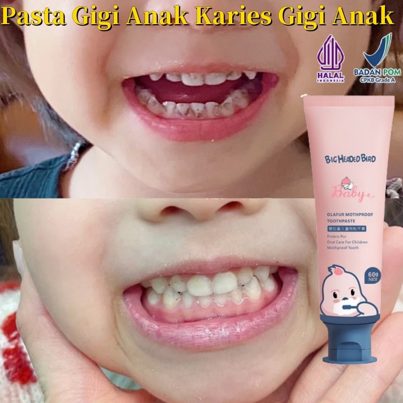 Jual Pasta Gigi Anak Karies Gigi Anak 60g Odol Anak 1-12 Tahun ...