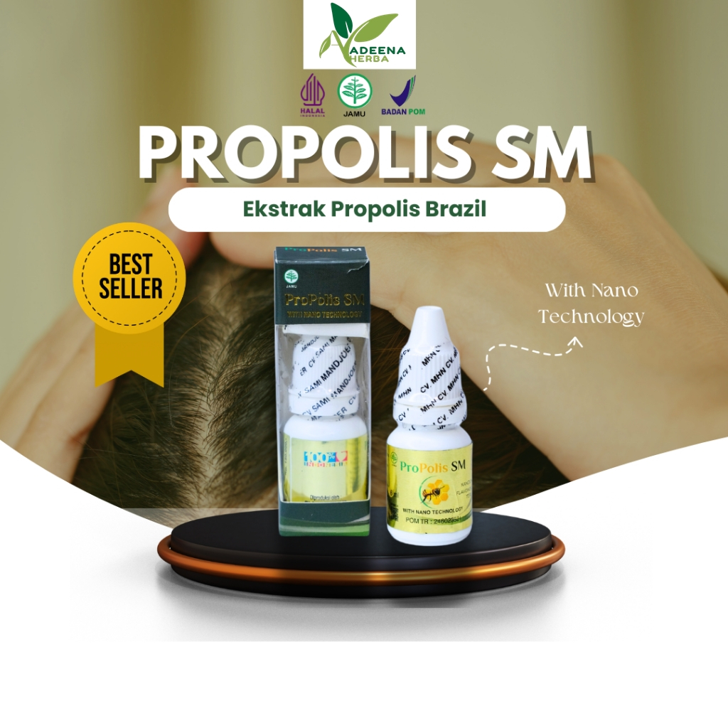Jual Aladeena Herba - Propolis SM Murni- Meringankan Jamur Di Kepala Bayi Anak dan Dewasa ...