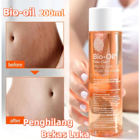 Jual 【100% ORI】BIO OIL Skincare Oil 200ML / Koreng Hitam Stretch Mark ...