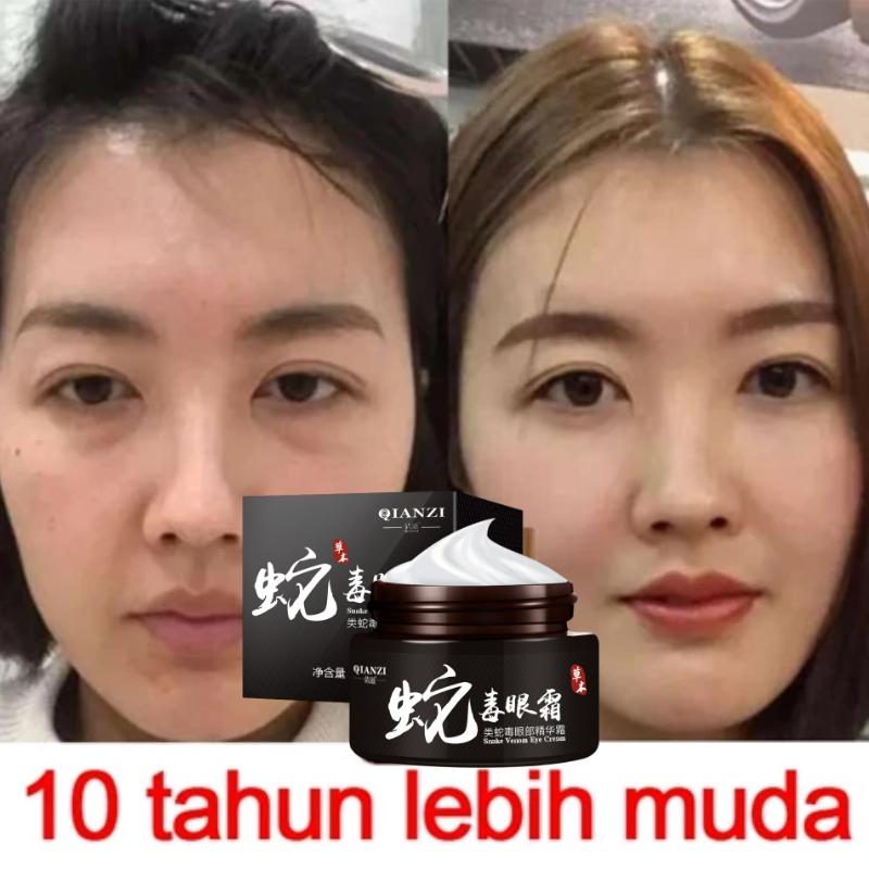 Jual Krim mata treatment mata Eye cream Kecantikan mata Krim mata panda Eye Bag Asam Hyaluronic ...