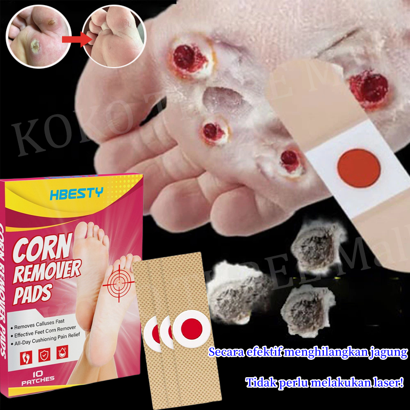 Jual Plester Kutil warts remover patch Plester Mata lkan dan Kutil Foot ...