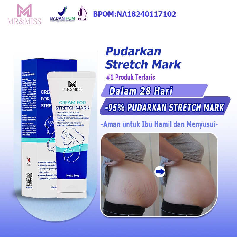 Jual MR&MISS Stretch mark cream Pelembab Cegah & Kurangi Stretch mark ...