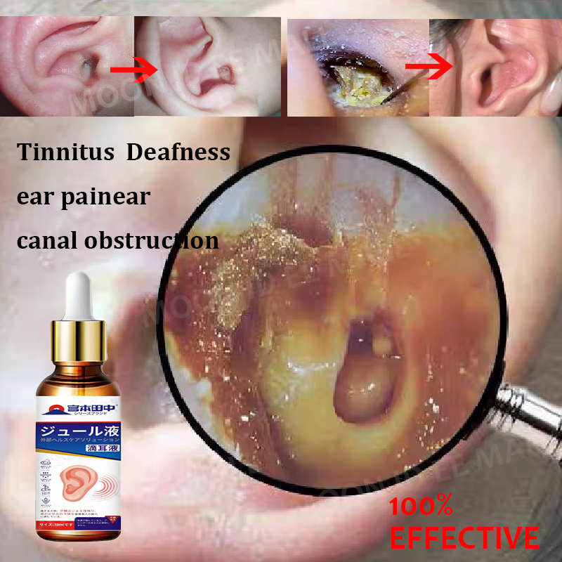 Jual Obat tetes telinga Cairan Pembersih Telinga Pembersih kotoran ...