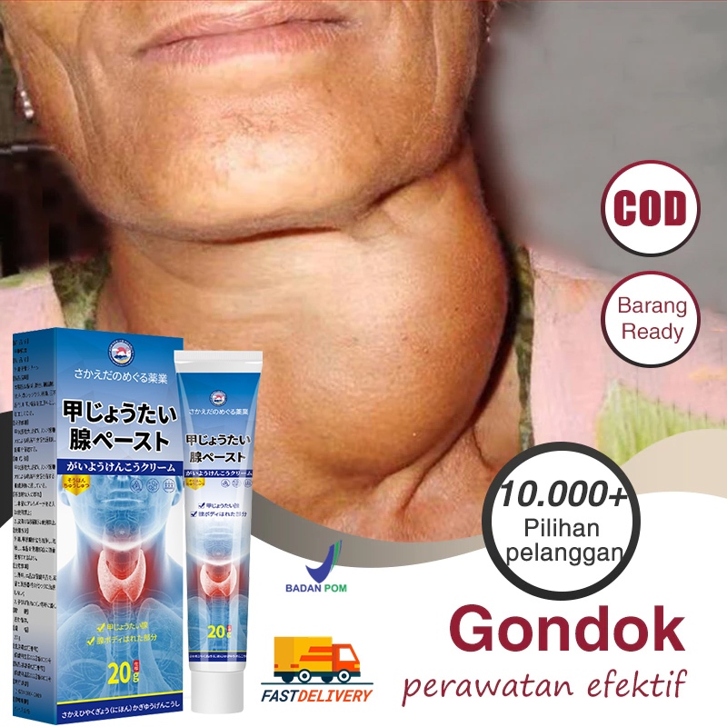 Jual Krim tiroid 20g Khusus Obat Gondok, Kelenjar Tiroid, Benjolan Di ...