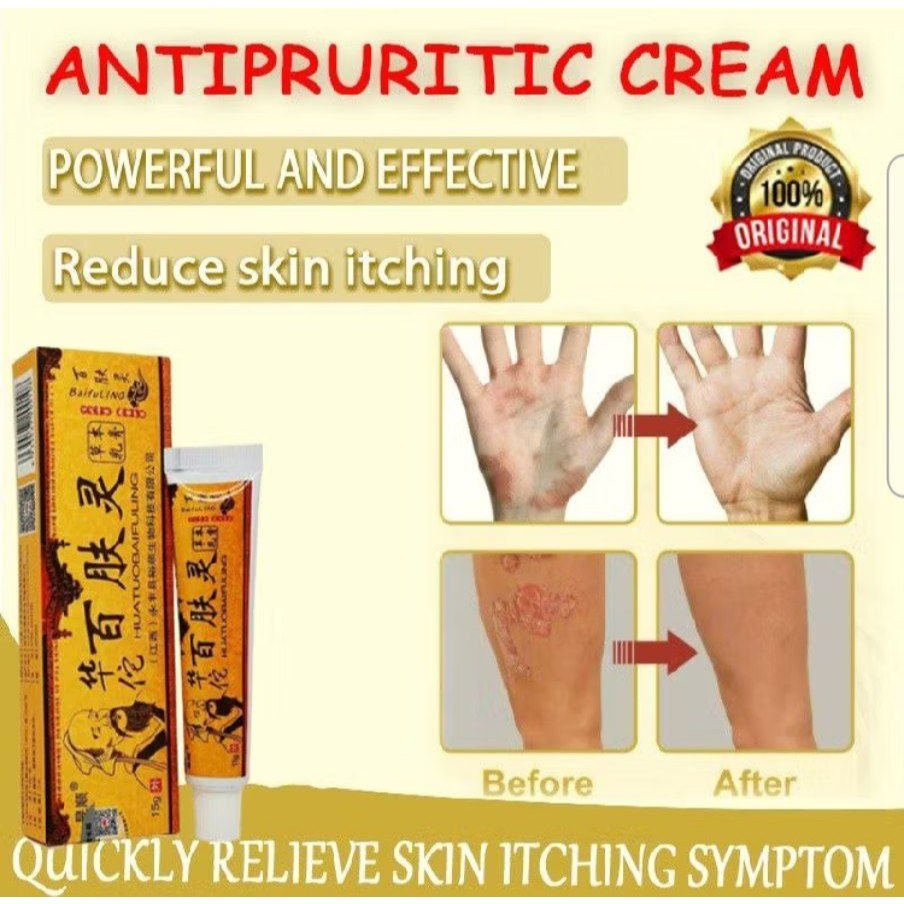 Jual PSORIASIS ITCHING OINTMENT ORIGINAL TABS | Shopee Indonesia
