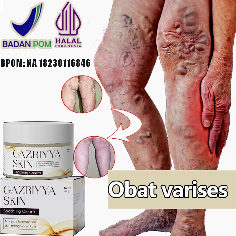 Jual Obat varises salep varises paling ampuh salep varises obat varises ...