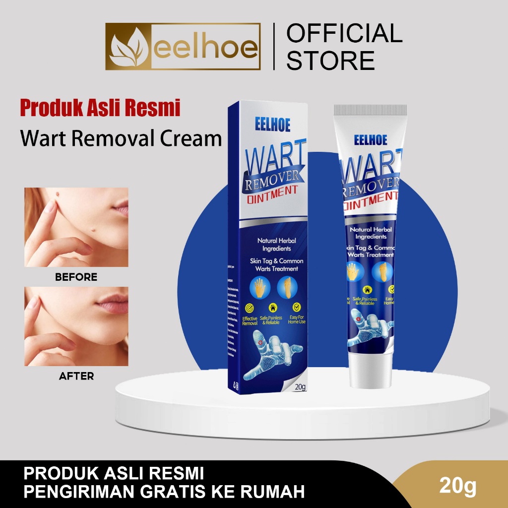 Jual EELHOE Wart Removal Cream Original Penghilang Kutil Di Wajah ...