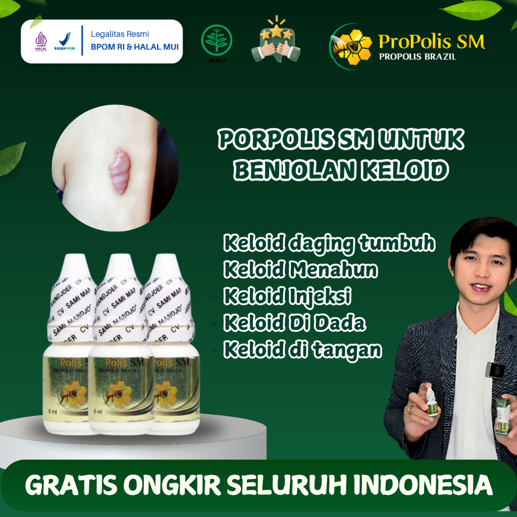 Jual Obat Benjolan Keloid Daging Tumbuh Menahun Bekas Operasi Injeksi Di Dada Tangan Telinga ...