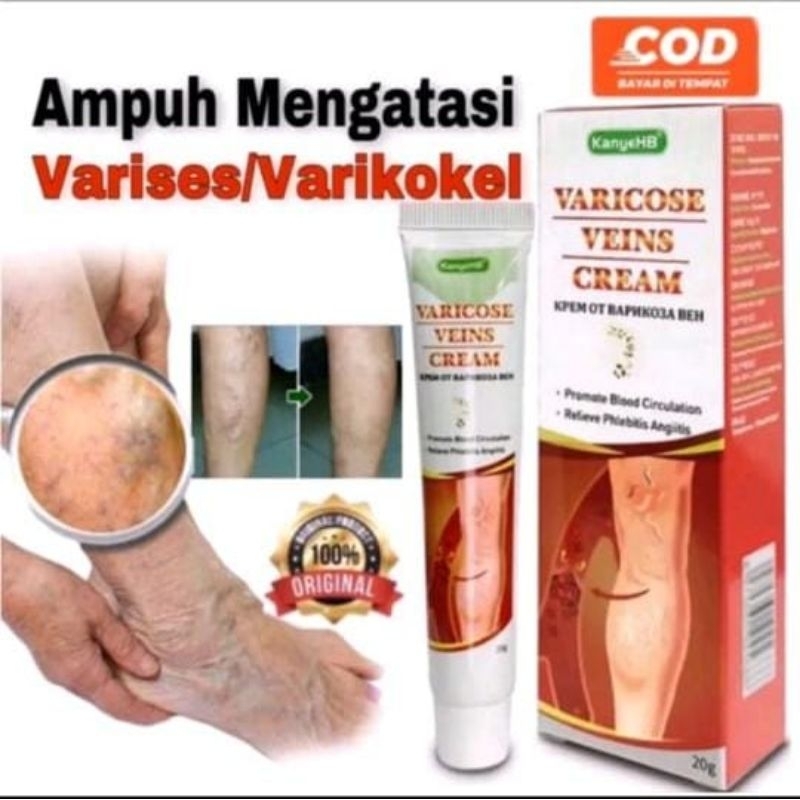 Jual Salep Cream Penghilang Varises VARISES VEINS VARICOSE 20 GRAM ...