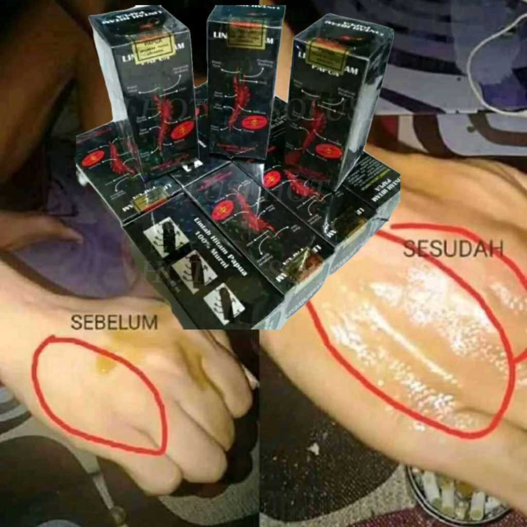Jual minyak lintah hitam asli 100% minyak pembesar pennis paling cepat minyak urut kelamin ...
