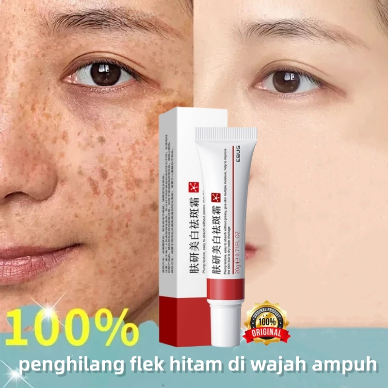 Jual krim penghilang flek hitam di wajah pemutih cream flek hitam membandel perawatan wajah ...