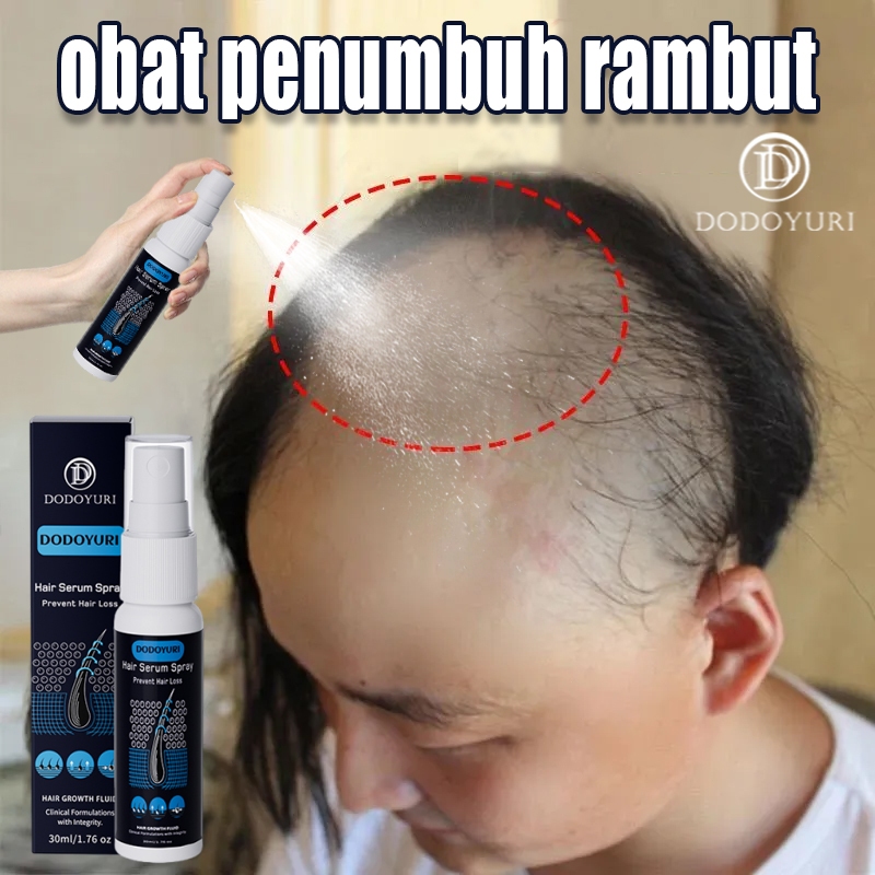 Jual 【BPOM】Obat penumbuh rambut serum penumbuh rambut hair tonic ...