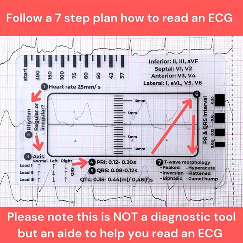 Jual Penggaris Ekg medis kedokteran ECG 7 Step Ruler 7 Step Scale for ...