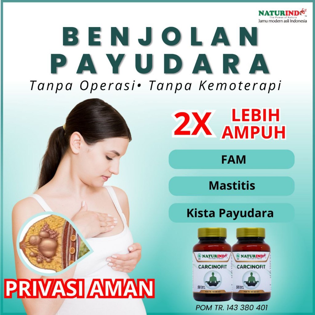 Jual Obat Benjolan Payudara FAM Mammae Kista Mastitis Bengkak Herbal Alami | Shopee Indonesia