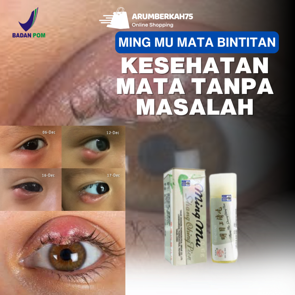 Jual Ming Mu Shang Qing Pian Original dari Fufang, Mengatasi Masalah ...