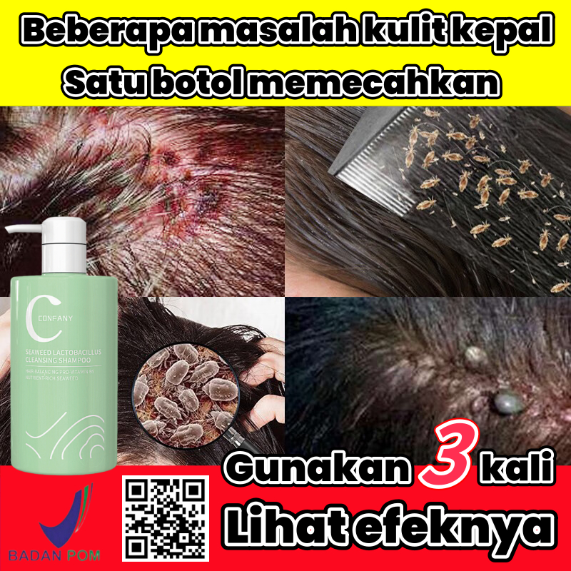 Jual Shampoo Kutu Rambut 500ML Shampoo Penghilang Kutu Shampoo Anti Ketombe Obat Ketombe Sampo ...