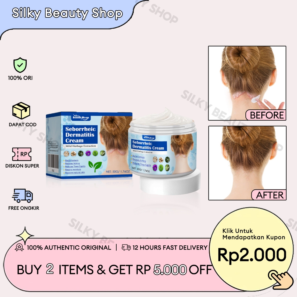 Jual South Moon【Beli 2 Gratis 1/COD】Seborrheic Dermatitis Cream 50g Seborrheic Skin Cream Krim ...
