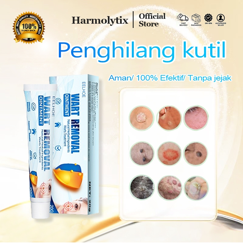 Jual Harmolytix Salep Kutil Paling Ampuh Penghilang Tahi Lalat Di Wajah ...