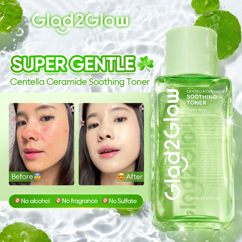 Jual [Toko Resmi]Glad2Glow Centella Ceramide Soothing Acne Cica Toner Wajah 80ml | Obat Jerawat ...