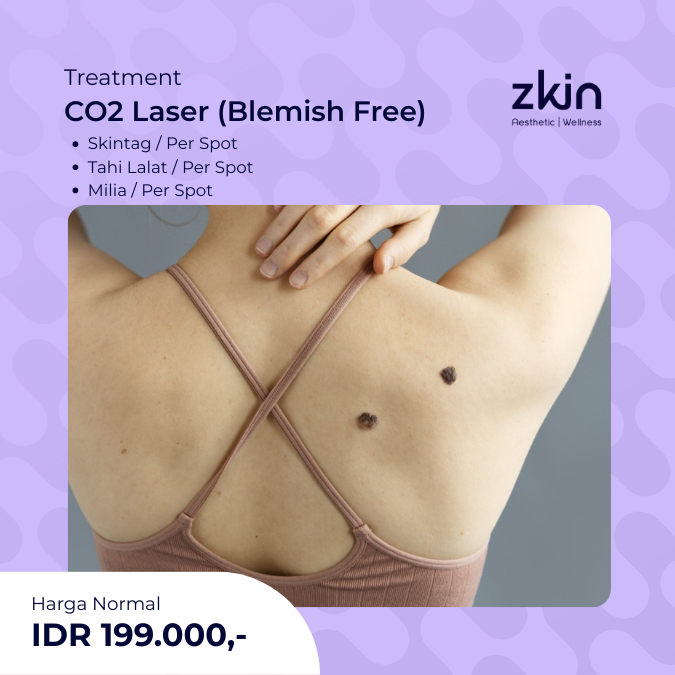 Jual ZKIN Clinic CO2 Laser (Blemish Free : Skintag, Tahi Lalat, Milia ...