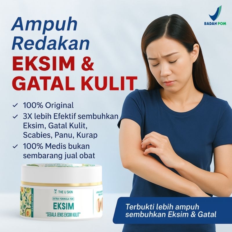 Jual Salep Eksim Herbal – Obat Gatal Kulit, Ruam, Kering & Mengelupas ...