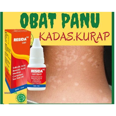 Jual RESIDA SC CAIR Obat Gatal Kulit Obat Panu Obat Kadas Obat Kurap ...