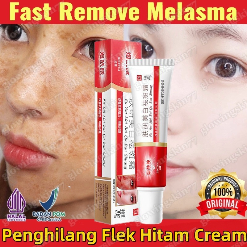 Jual Cream Penghilang Flek Hitam Cream 20g Pemutih Wajah Niacinamide ...