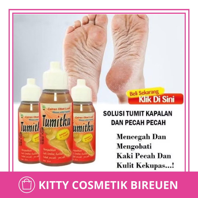 Jual Tumitku - Obat Kapalan dan Kaki Pecah-Pecah 30ml | Shopee Indonesia