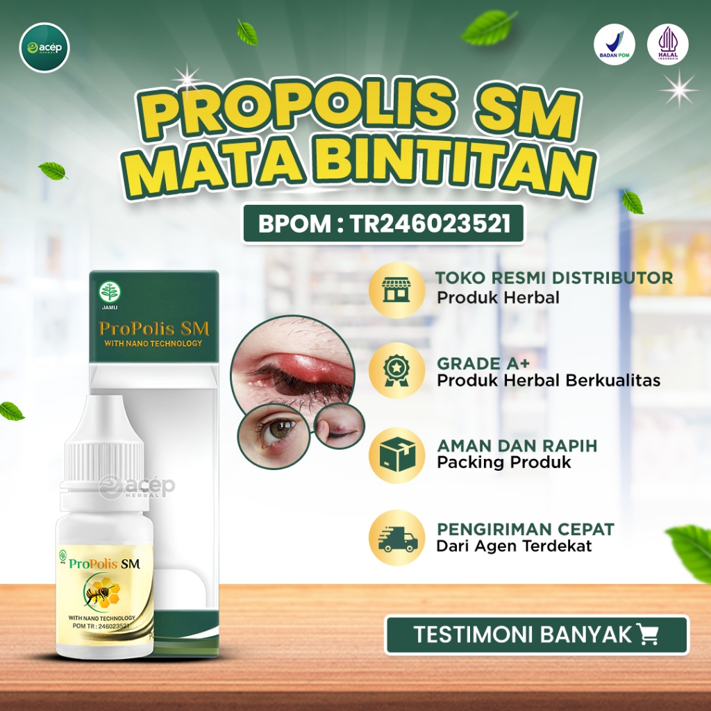 Jual Obat Mata Bintitan Mata Kalazion Mata Bengkak Mata Hordeolum ...